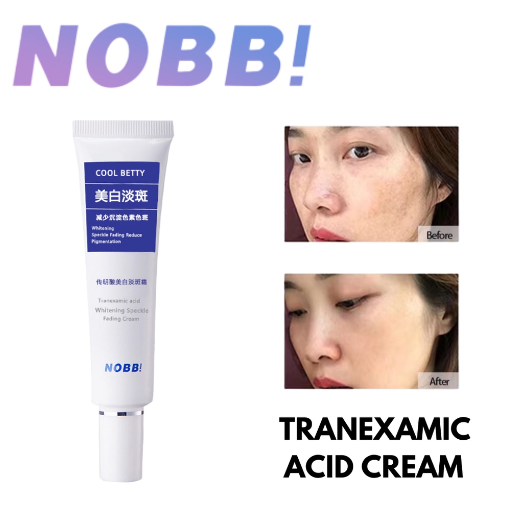 NOBB Tranexamic Acid Whitening Anti-Freckle Cream Remove Wrinkles ...