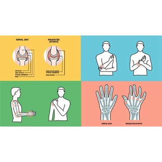 Authenticated SKML Rheumaton 30s (1 bottle ) | Shopee Philippines