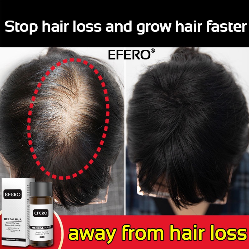 EFERO hair Growth Essence Serum help hair regrow(Hair tonic Hair ...