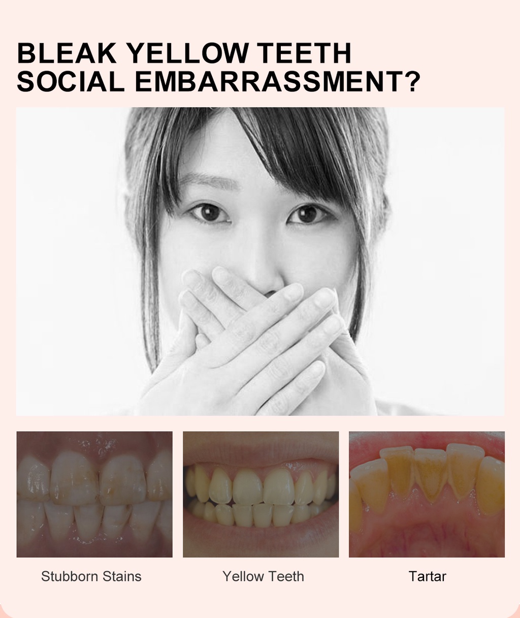 MeiYanQiong FDA Teeth Pen Teeth Whitening Cleaning Tartar Remover ...