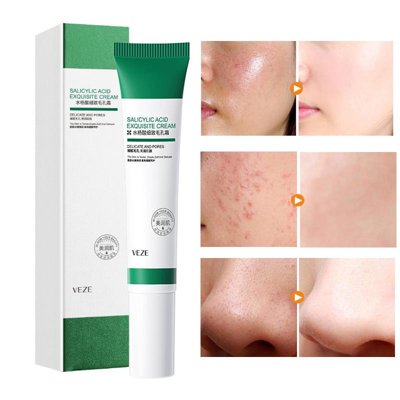 20ml Salicylic Acid Pores Shrink Cream Moisturizing Repairing Remove