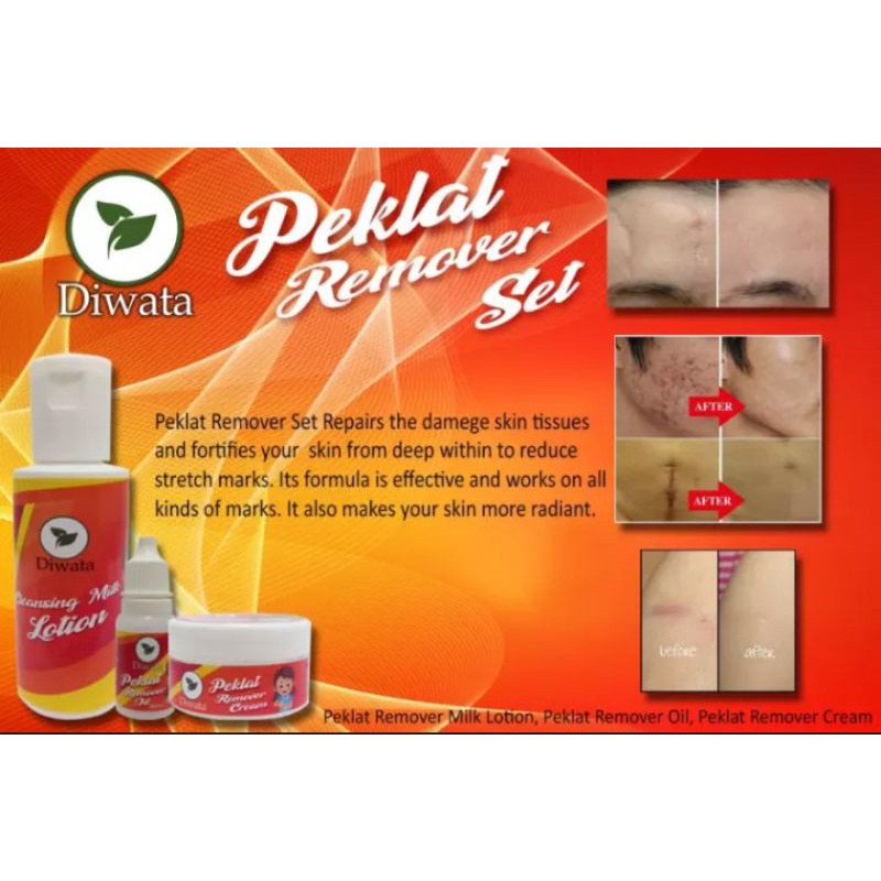 Diwata Peklat Remover Set | Shopee Philippines