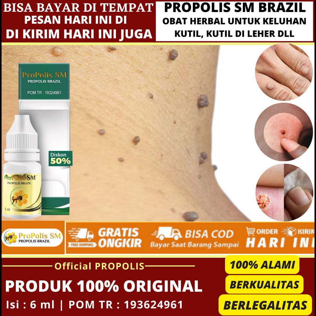 Medicines, Wart Medicines On The Neck Paploma Wart Remover Remove Meat ...