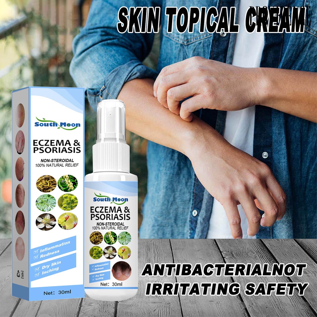 P2 30ml Psoriasis Spray Anti Inflammatory No Adverse Reaction Herbal