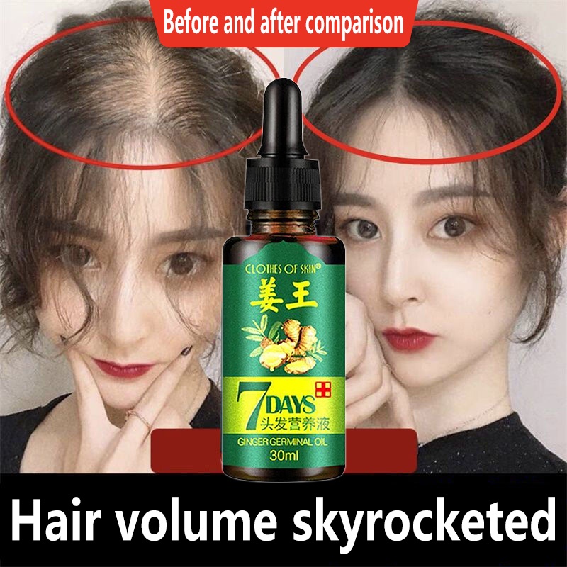 Ginger King Natural Chinese Herbal Formula Hair Nutrient Solution Solid