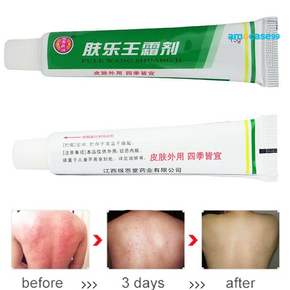 amocase99 Fule Wang Shuangji Skin Psoriasis Dermatitis Eczema Treatment ...