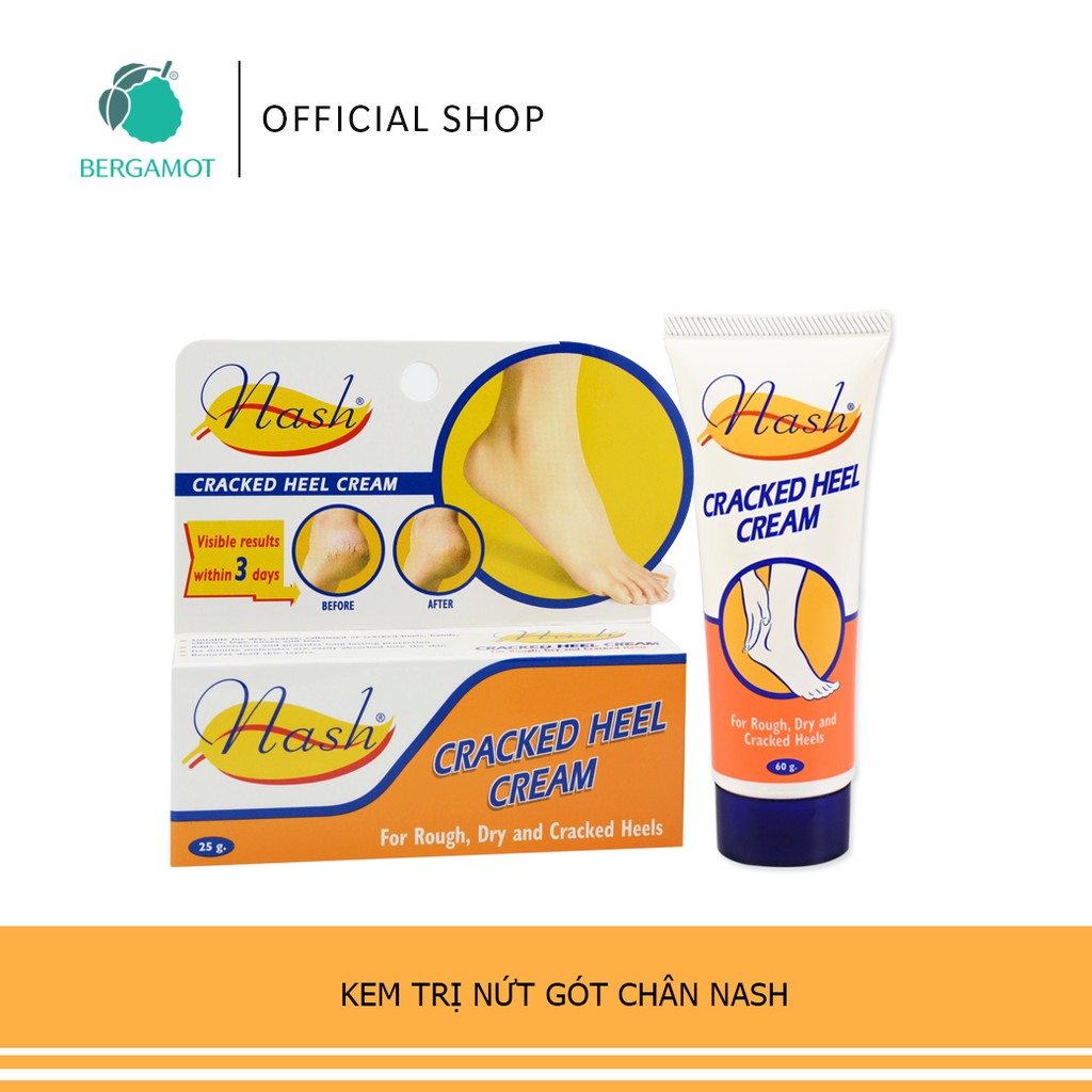 Nash Cracked Heel Cream | Shopee Philippines