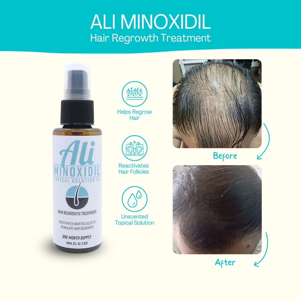 Ali Hair Grower Minoxidil 5% Hair Growth Anti-Hairloss Treatment Hair ...