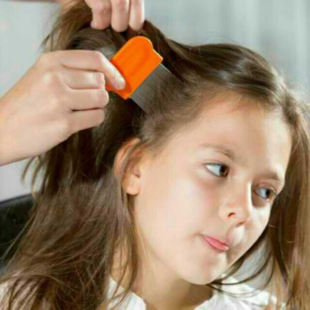 CHAINSTORE Magic Head Lice Remover Comb Magic Suyod (COLOR MY VARY ...