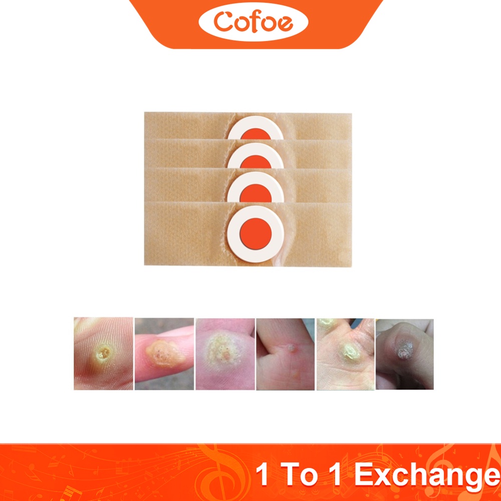 Cofoe 6pcs/box Medical Plaster Corns Patches Remove Thorns Wart Removal ...