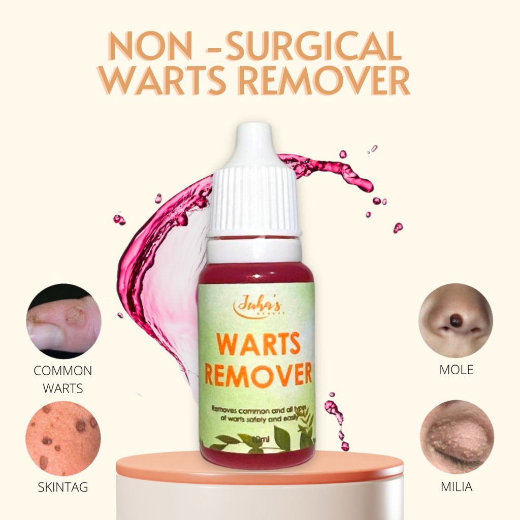Effective Pure Kasoy Oil Warts Remover Mole Millia Syringoma Skintag ...