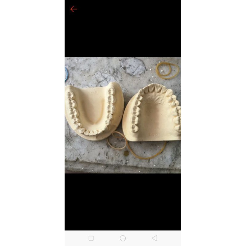 1pair dentulous cast upper &lowet | Shopee Philippines