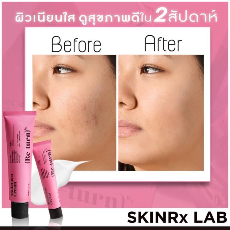 Skinrx LAB MadeCera Re-Turn Cream 15ml (Thai label) | Shopee Philippines
