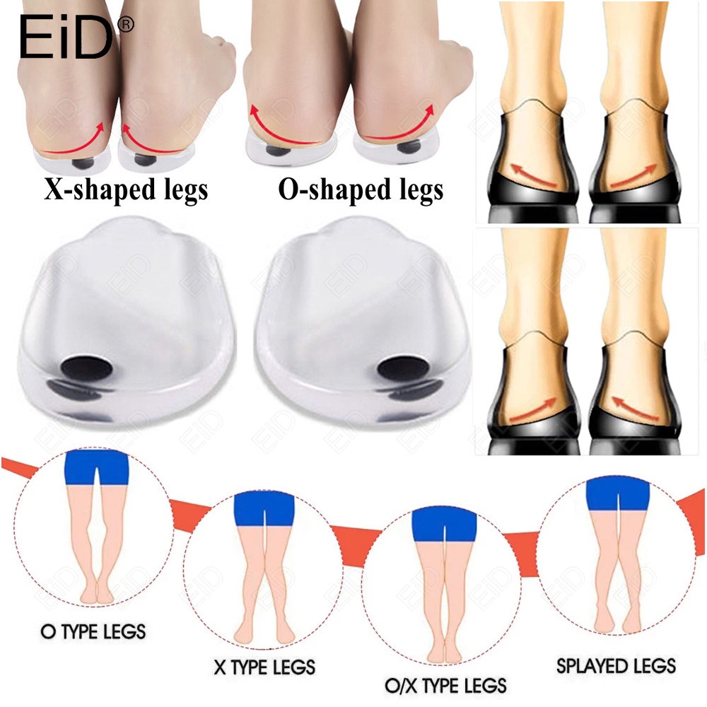 EiD Silicone Gel Varus Orthotic Insole X/O Legs Correction Orthopedic ...