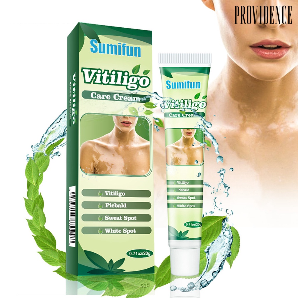 P2-20g Vitiligo Cream Quick Absorb Anti-Itch Gentle Texture White Spot ...