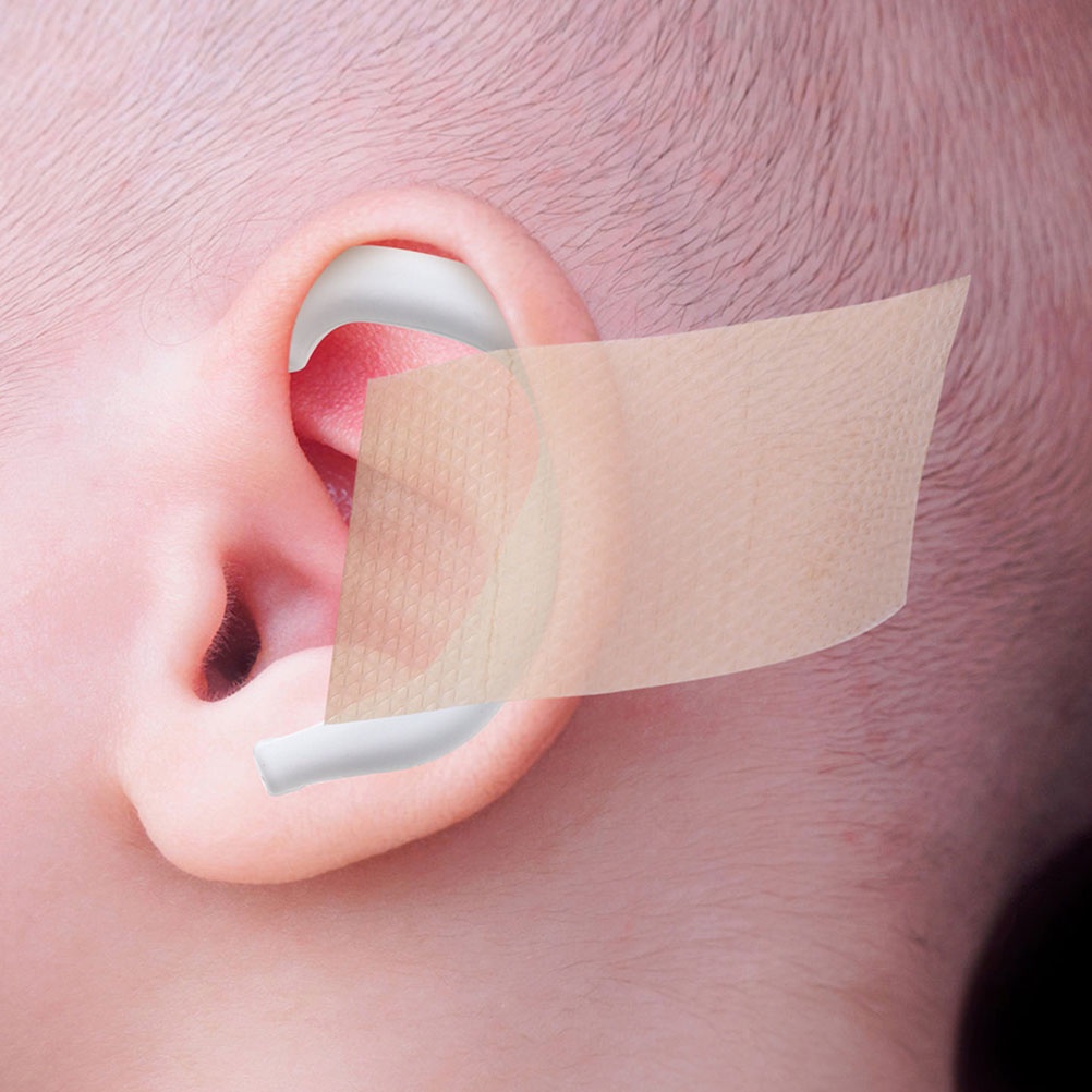 [READY STOCK] Auricle Valgus Correction Patch External Corrector Infant ...