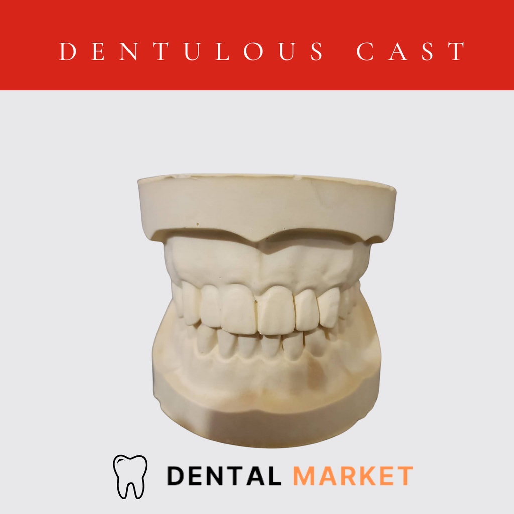 Dentulous Model Cast,(Upper and Lower),Dental Market Supply | Shopee ...