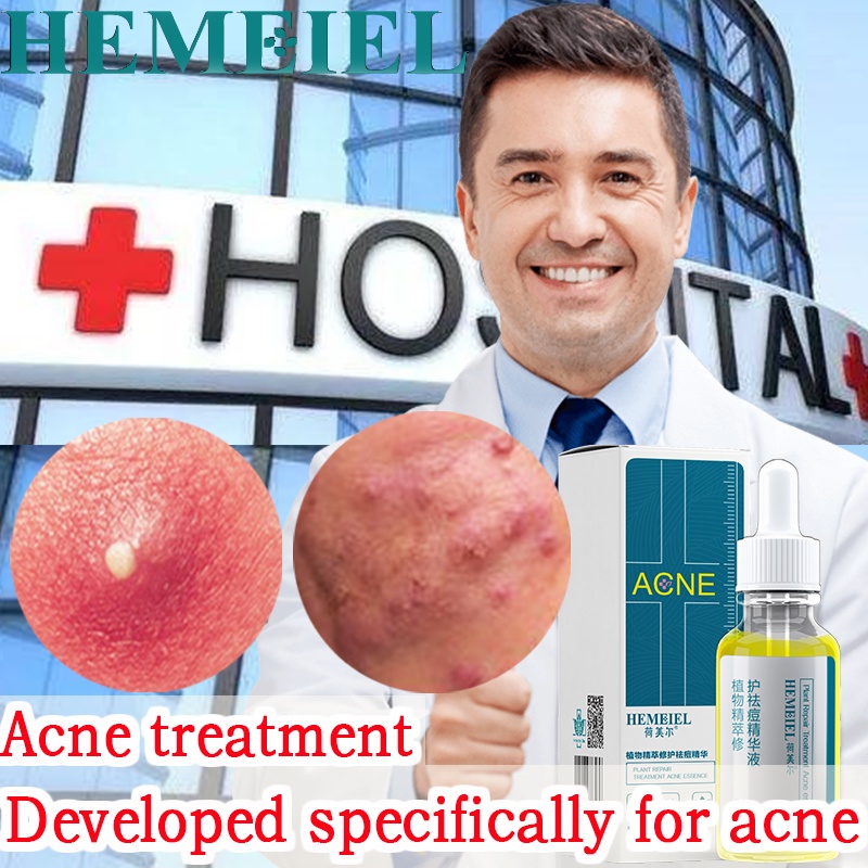 HEMEIEL- Plant acne repairing cream,acne scar remover pimple marks cream,Fast Acne Treatment ...