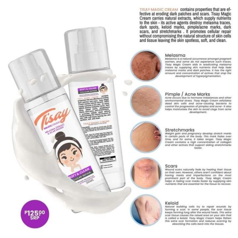 Tisay Magic Cream Melasma, Pekas, Scar Eraser | Shopee Philippines