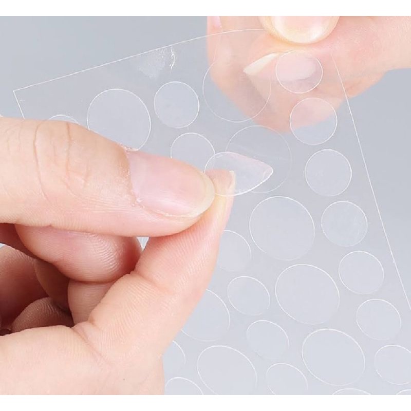 Msc Spot Patch Acne Treatment Shopee Philippines