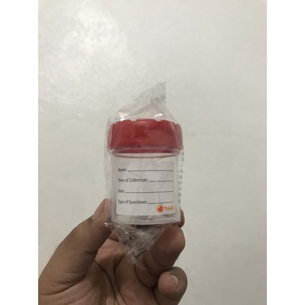 Urine / Stool Specimen Container Bottle (Sterile with Label) 10 pcs and ...
