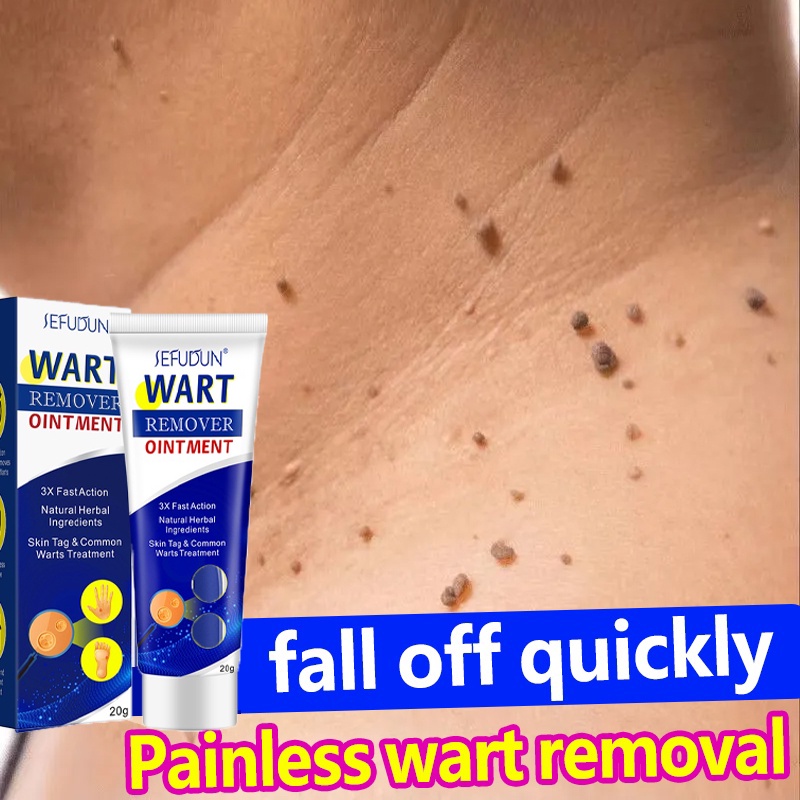 20G Warts Remover Original Cream Remove Common Warts Flat Warts ...