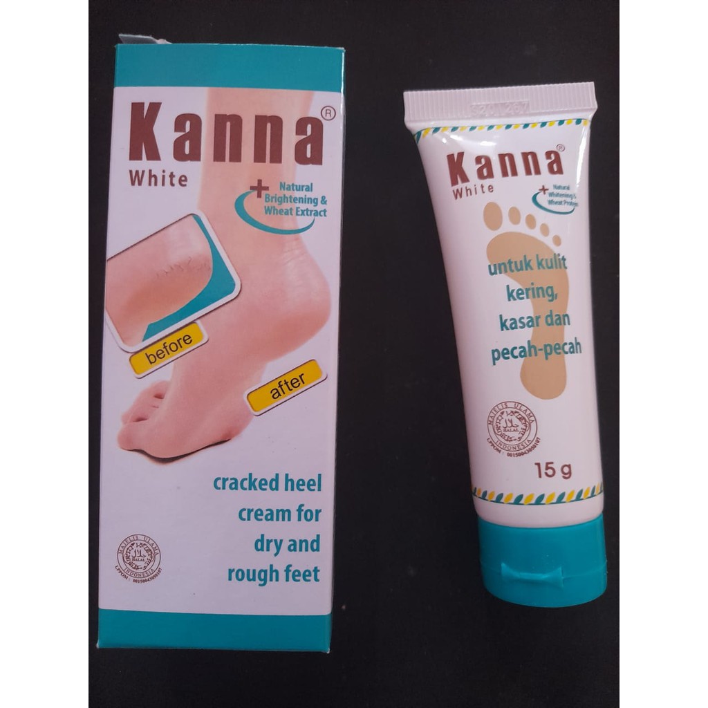Kanna Cream White For Feet/Heel 15g | Shopee Philippines