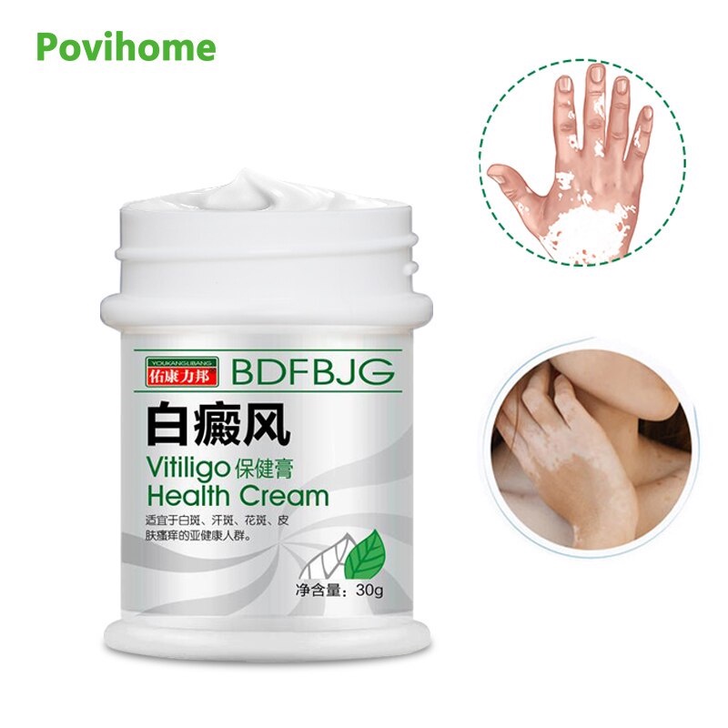 White Spot Vitiligo Treament Cream Leukoplakia Disease Repair ...