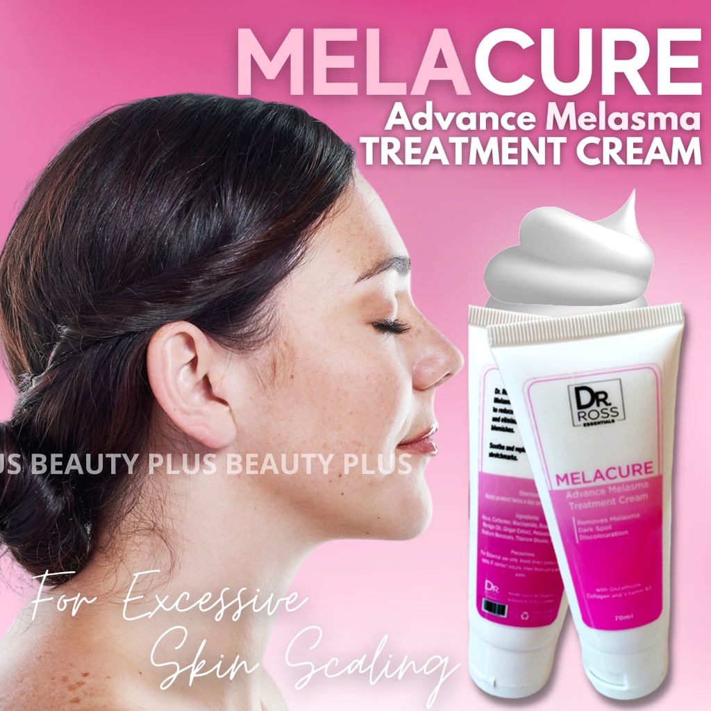 [ BEAUTY PLUS ] Melacure Advance Melasma Treatment Cream with VITAMIN B3 100%EFFECTIVE Healthy ...