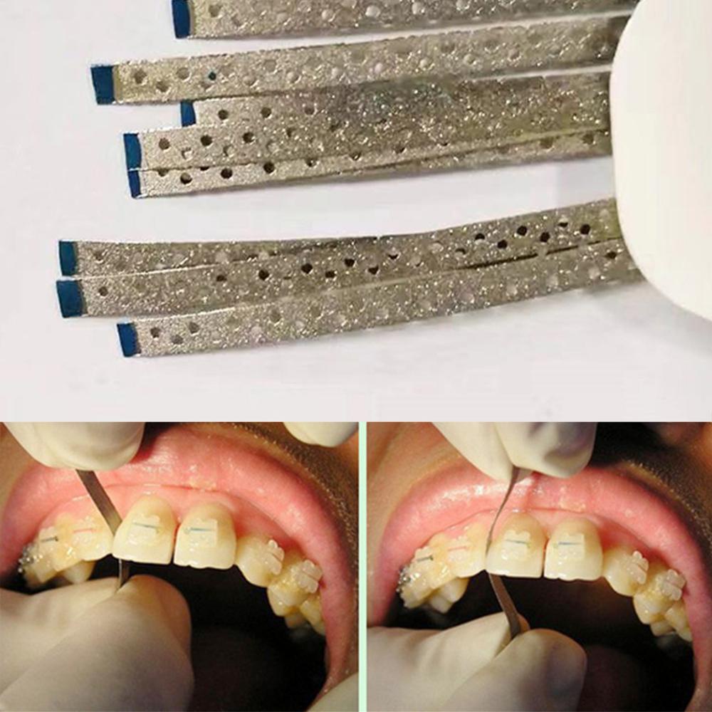 WS-37 IPR Diamond Abrasive Dental Polishing Strips (Single Side ...