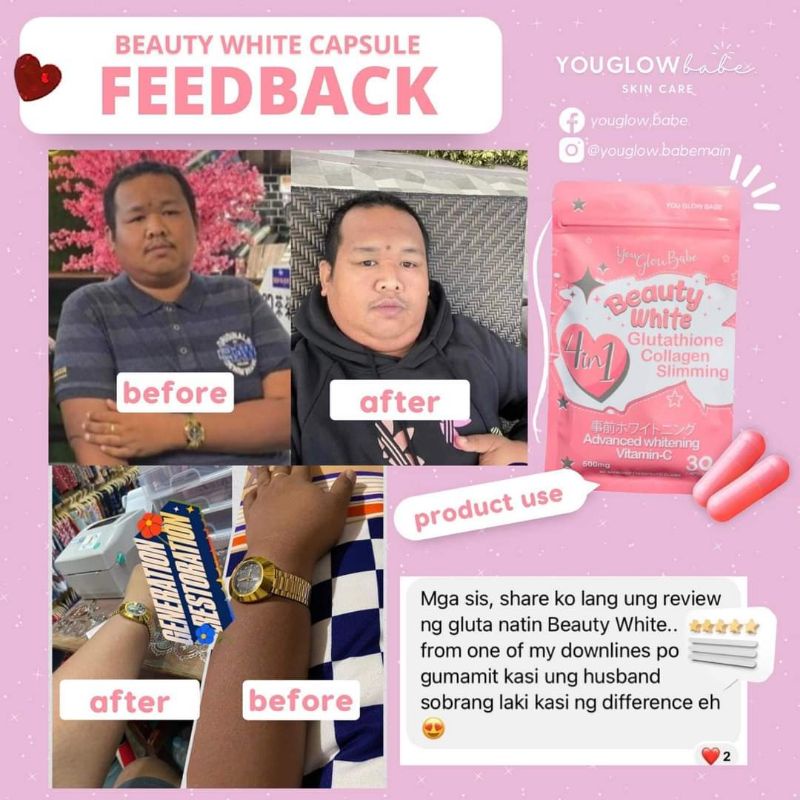 You Glow Babe Beauty White On Hand Shopee Philippines