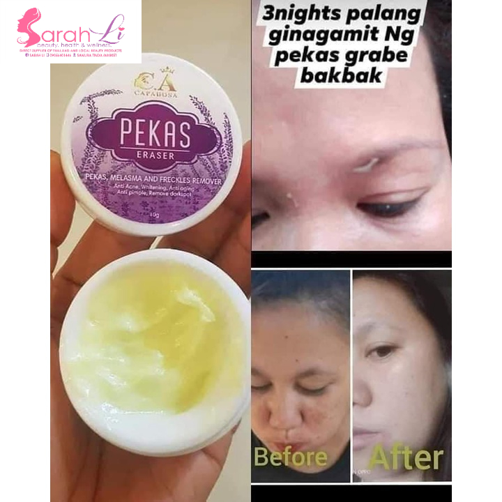 Original Pekas skin lightening cream 10g | Shopee Philippines