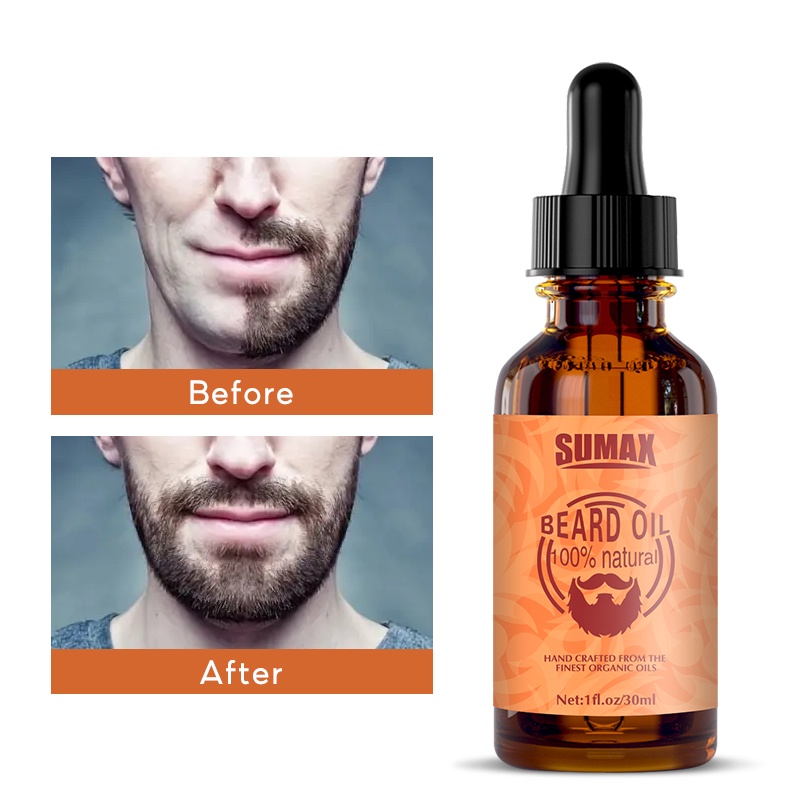 Crafted Beard Growth Kit - The Best Beard Growth Kit - Grow A Thicker ...