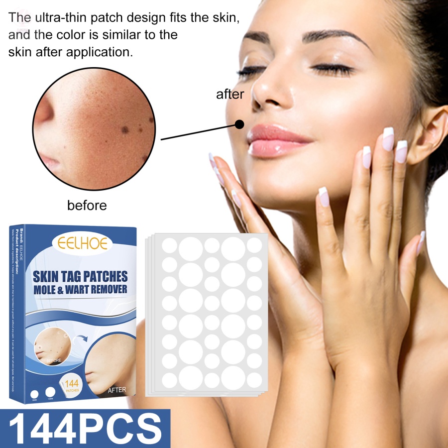 GLAMN 144Pcs Skin Tag Warts Treatments Set Remove Patch Warts Remover ...