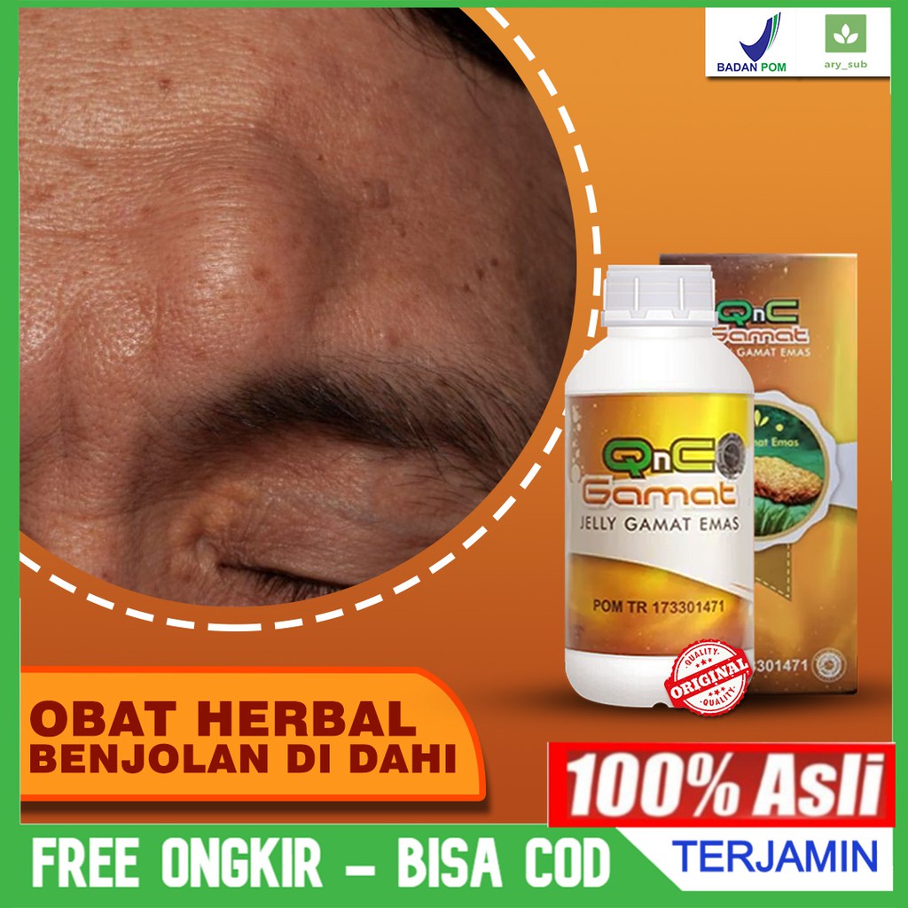 Medicine for lumps on the forehead - lumps on the forehead - lumps on ...