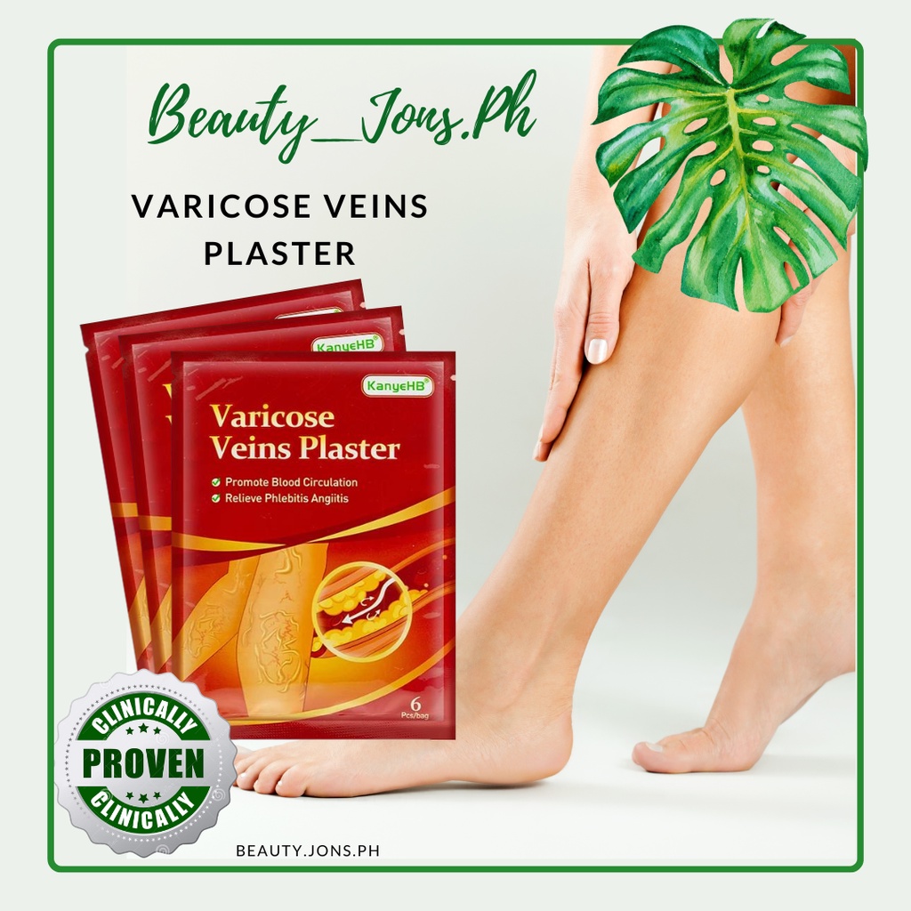 ORIGINAL VARICOSE VEINS PLASTER | Varicose Veins Pain Relief Plaster ...