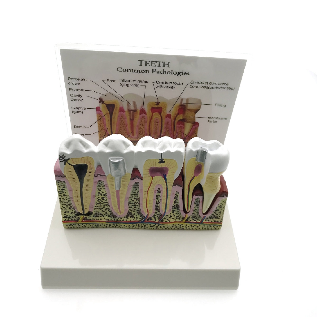 Dental Tooth Teeth Anatomical Model Dental Anatomy Teeth Model ...