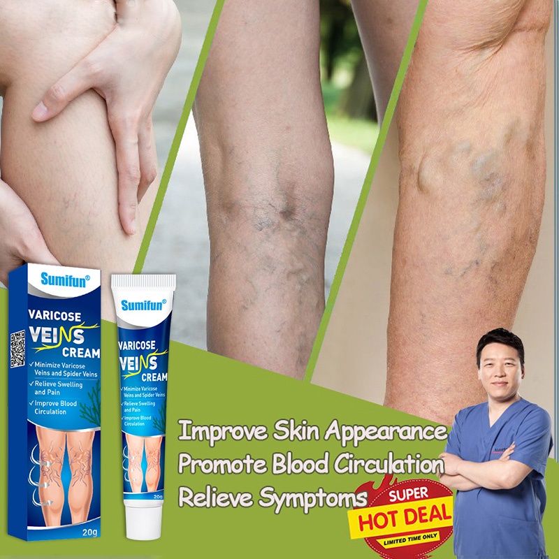 Sumifun Varicose Vein Remover Cream Treatment Varicosity Angiitis ...