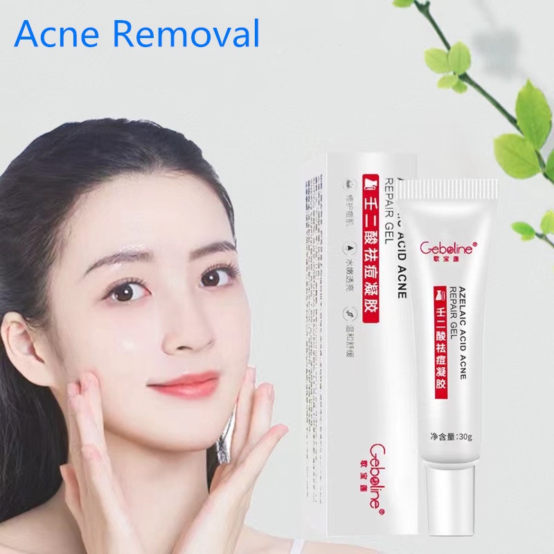 GEBOLINE Acne Cream 15% Azelaic Acid Acne Cream Naturally Moisturizing ...
