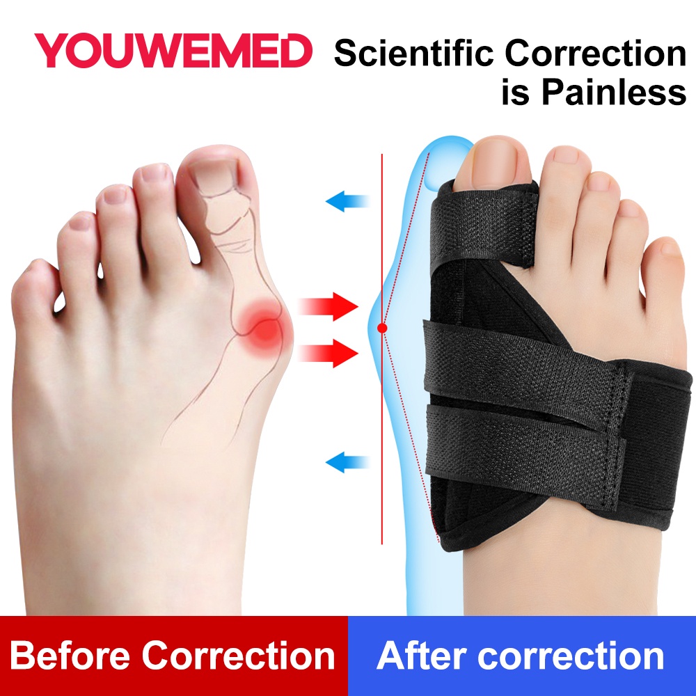A Pair Soft Bunion Corrector Toe Separator Correction System Device ...