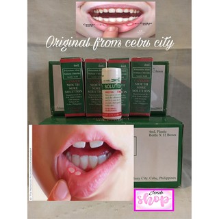 Canker mouth sore solution 4ml/singaw treatment | Shopee Philippines