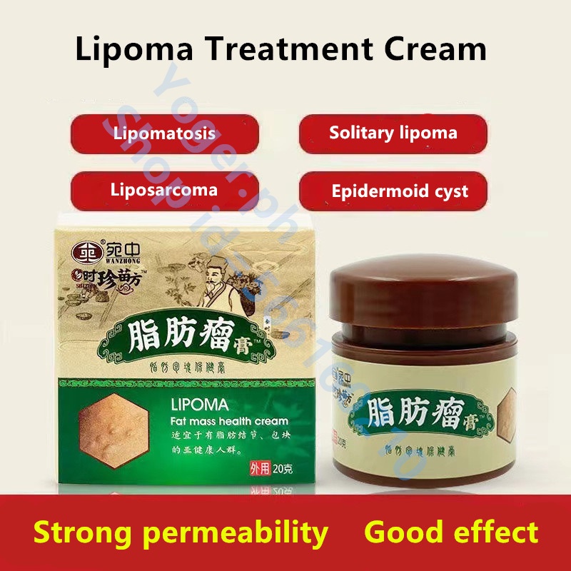 20g/box Lipoma Health Cream Specially Relieve Lipoma Lipomatosis ...