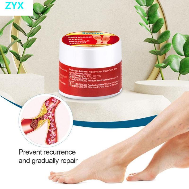 Sumifun Varicose Veins Cream Anti-swelling Red Capillary Vasculitis ...