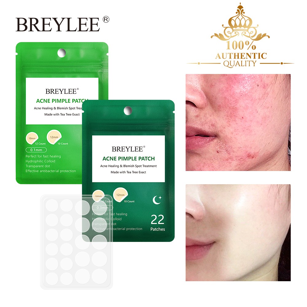 BREYLEE Acne Pimple Patch Acne Treatment Remove Blackheads Treat Acne ...