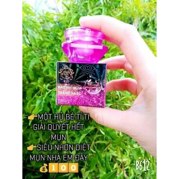 Acne Cream 2c Helps Remove Acne, Freckles Genuine | Shopee Philippines