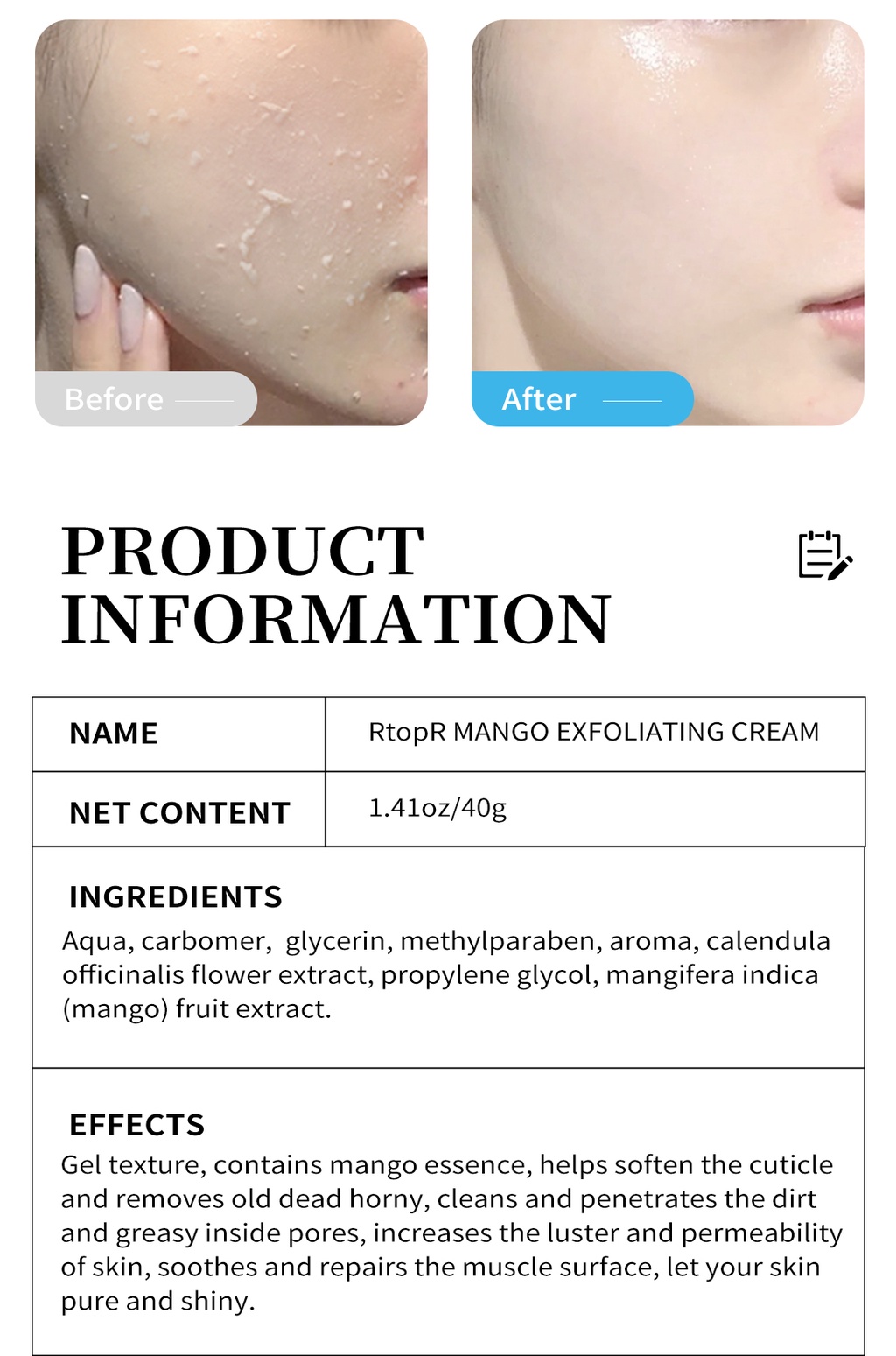 RtopR Mango Face Exfoliating Repair and Whitening Skincare Set | Shopee ...