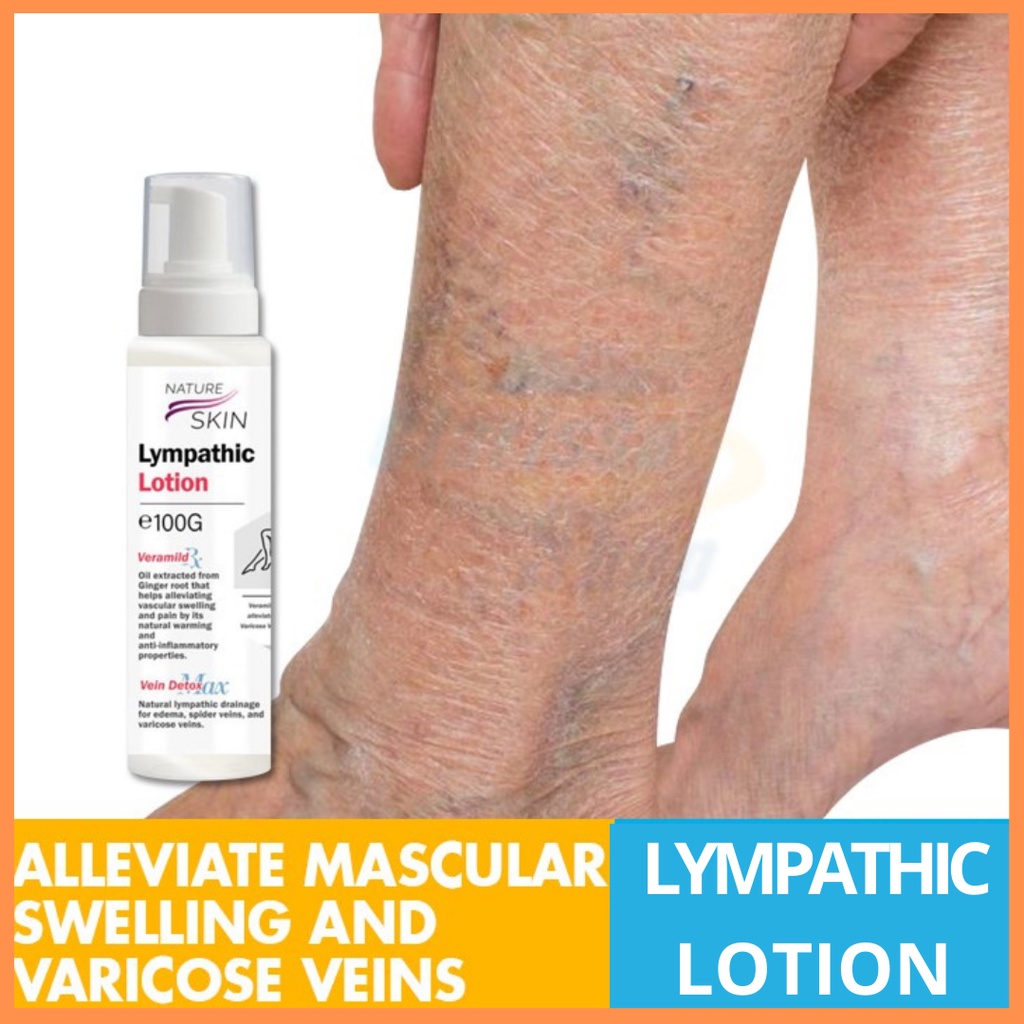 Lymphatic Lotion for Varicose veins and spider veins CASH ON DELIVERY ...