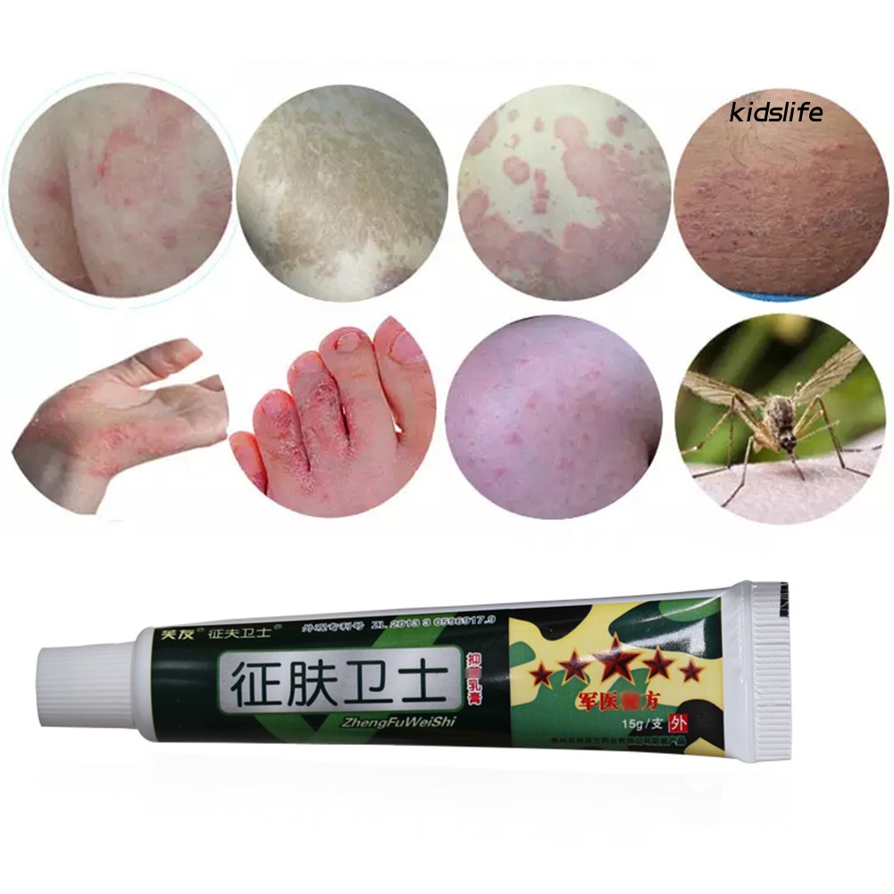 Kidslife-15g Herbal Ointment Antibacterial Relieve Itching Skin ...