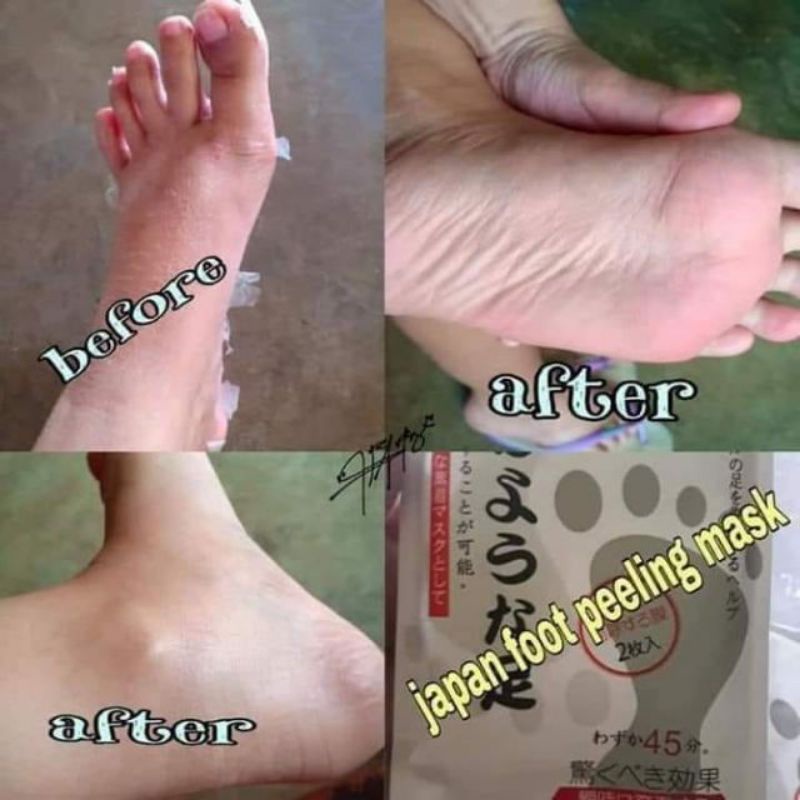 JAPAN FOOT MASK FOOT PEELING MASK FOR HEALTHY YOUNG LOOKING FEET ...