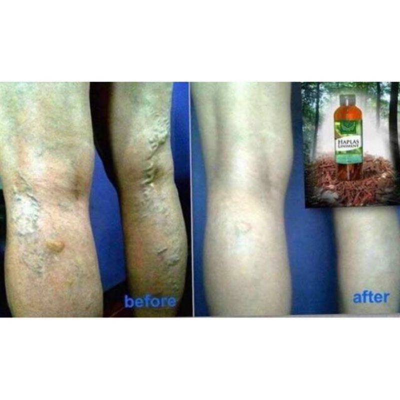 Haplas liniment original | Shopee Philippines